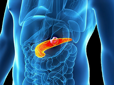 التهاب البنكرياس - وسم | الطبي