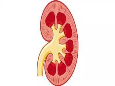 Nephrorrhagia Nephron definition/meaning